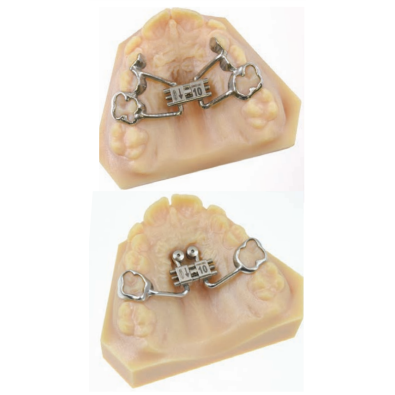 Expansor de Palato Anatômico CAD-CAM